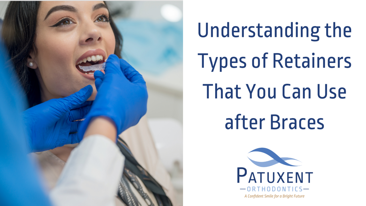 The Types of Retainers You Can Use After Braces!