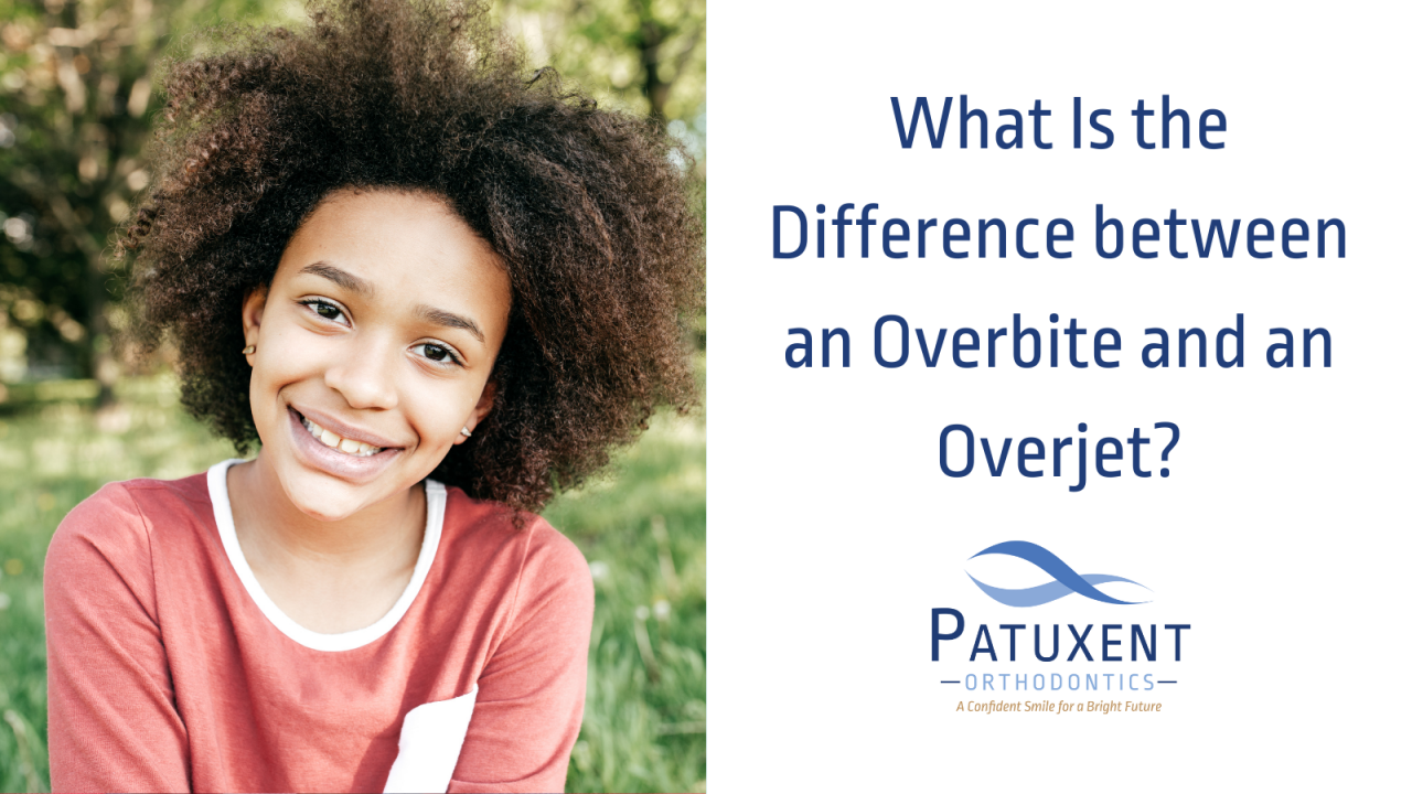 What is the Difference Between an Overbite and an Overjet?