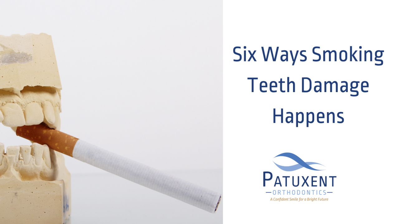 6 Ways Smoking Teeth Damage Happens