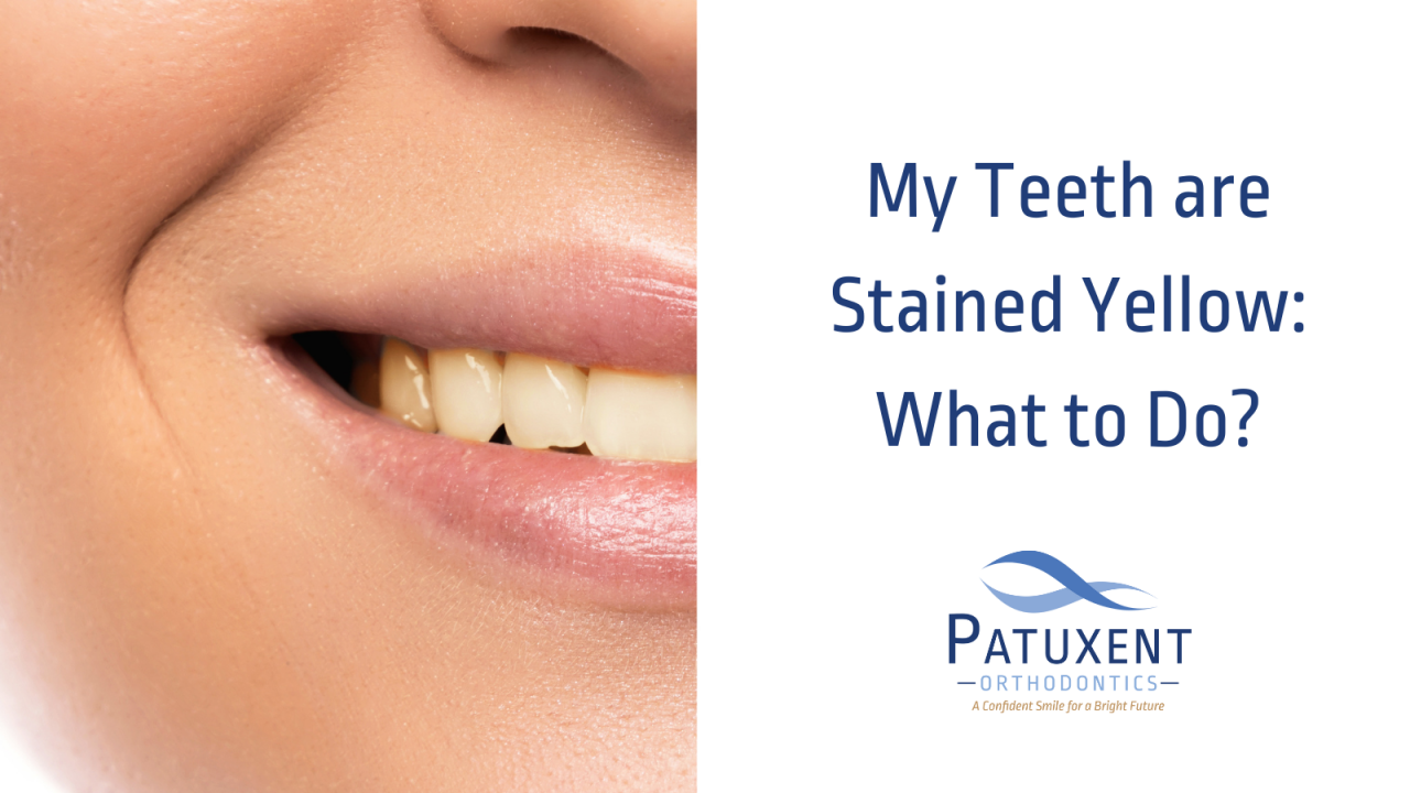 My Teeth are Stained Yellow: What to Do?