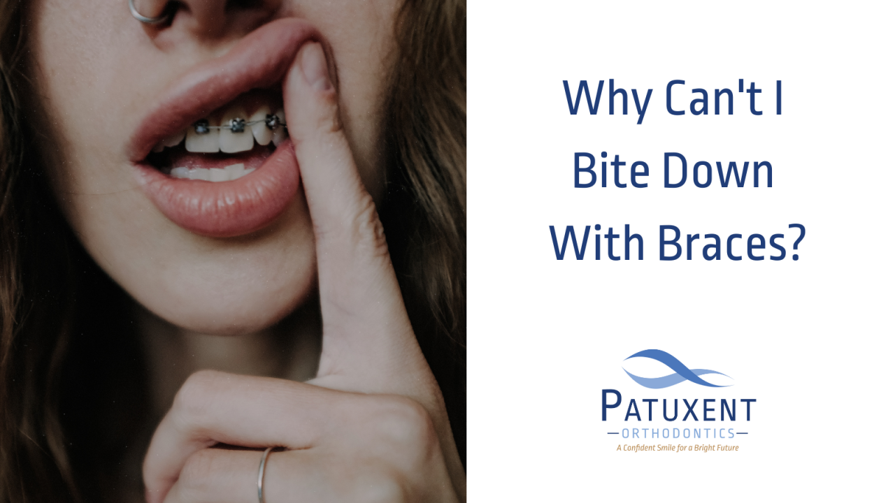 Why Can't I Bite Down With Braces?