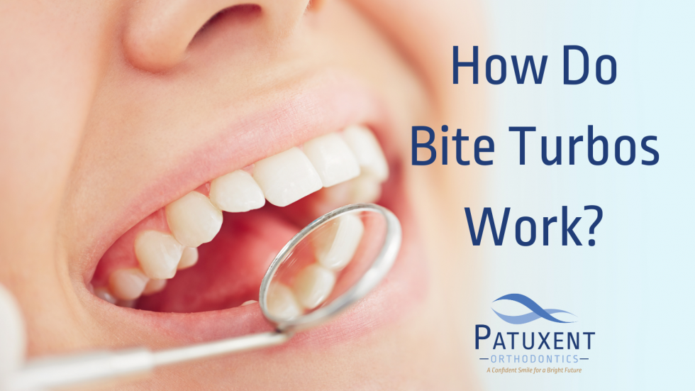 How Do Bite Turbos Work? - Patuxent Orthodontics