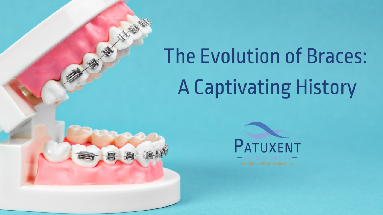 The Evolution of Braces: A Captivating History