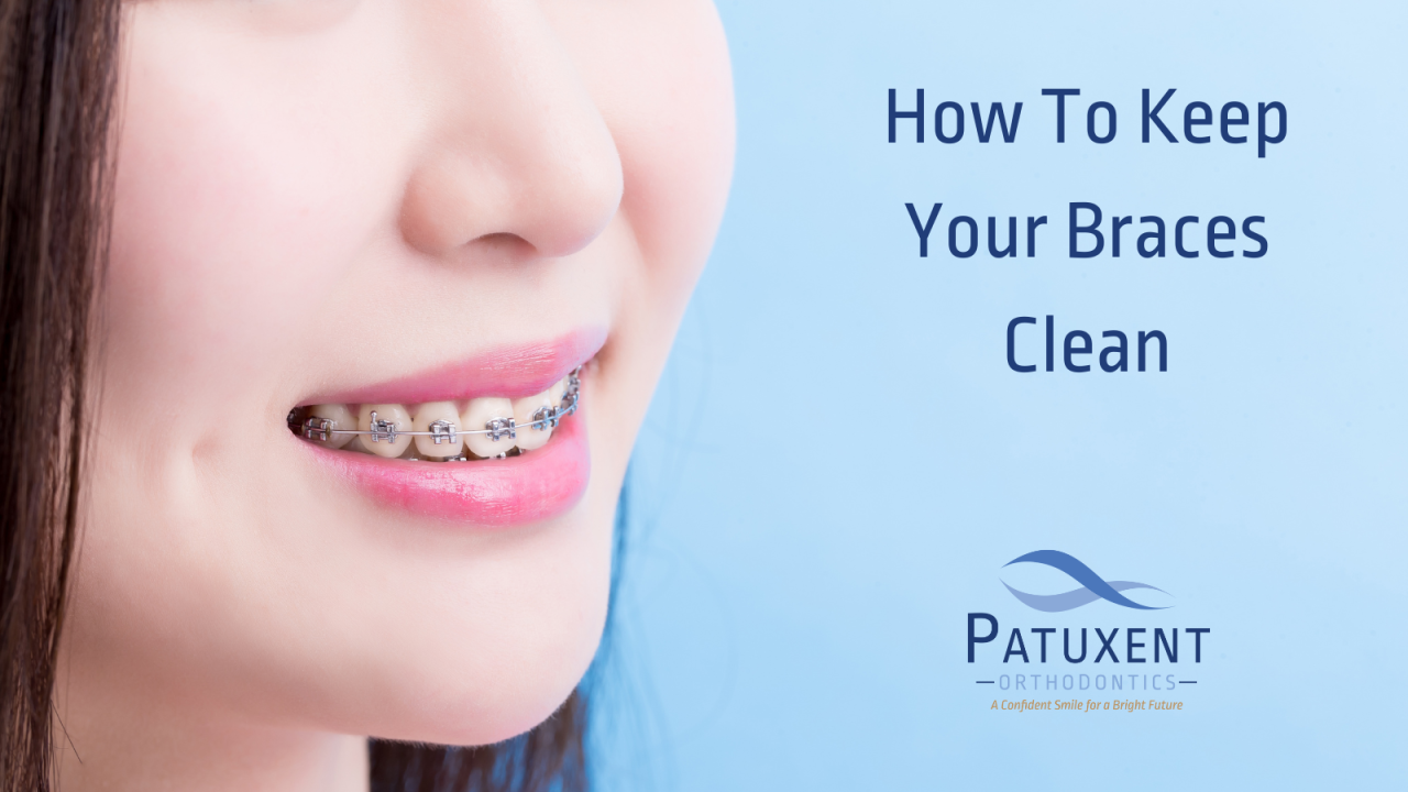 How to Keep Your Braces Clean