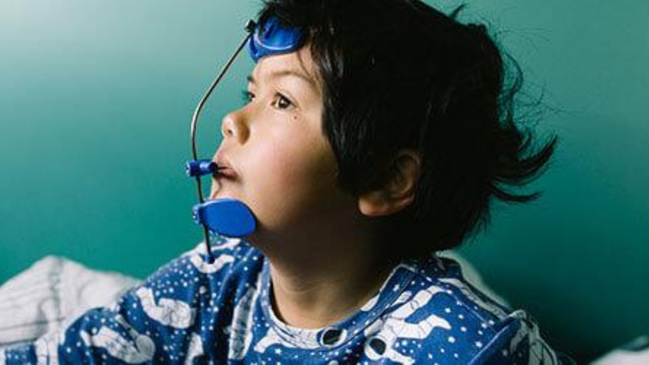 Orthodontic Headgear: Outdated Option or Viable Choice?