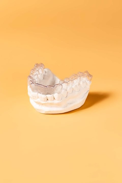 Dental Night Guards in Hollywood, MD | Patuxent Orthodontics