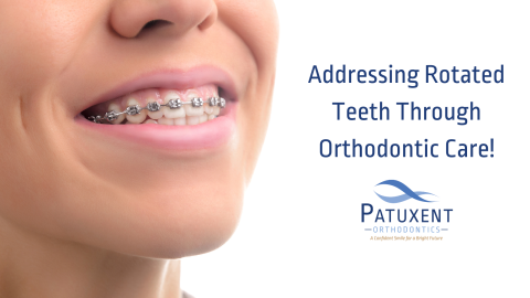 Addressing Rotated Teeth Through Orthodontic Care!