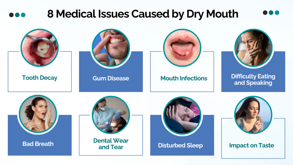 Why Am I Getting Dry Mouth Even after Drinking Water?