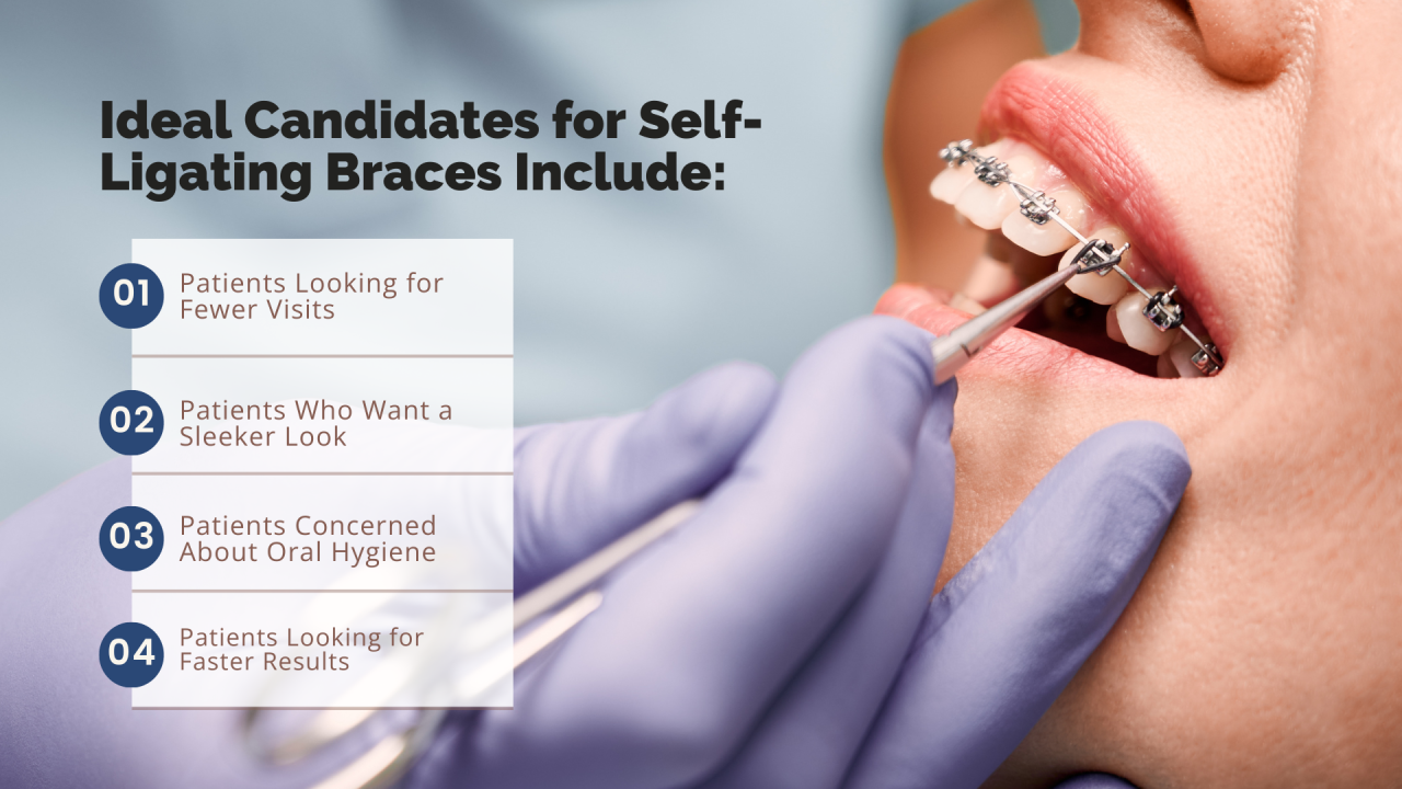The Role of Self-Ligating Braces in Your Orthodontic Treatment