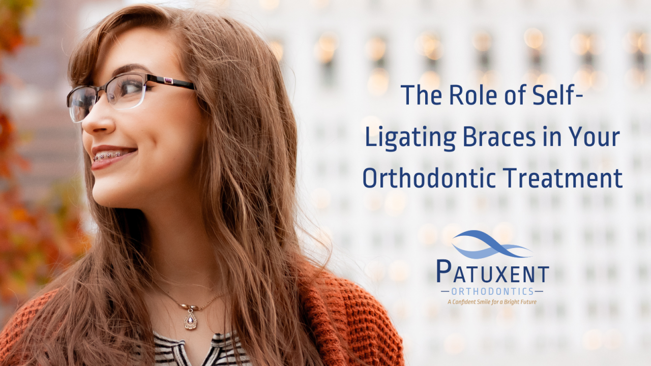 The Role Of Self Ligating Braces In Your Orthodontic Treatment