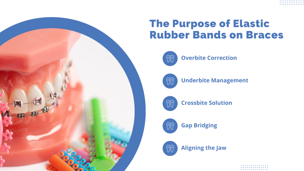 What Are the Rubber Bands for Braces Used For?