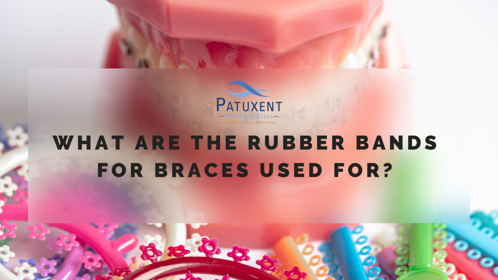 What Are the Rubber Bands for Braces Used For?