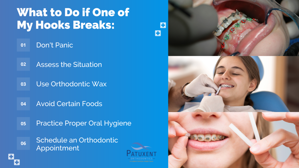 What Are the Hooks on Braces For?