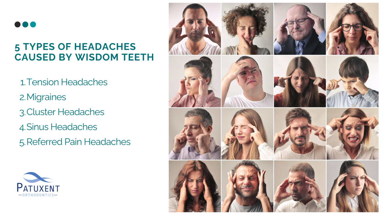 Why Are My Wisdom Teeth Giving Me a Headache?
