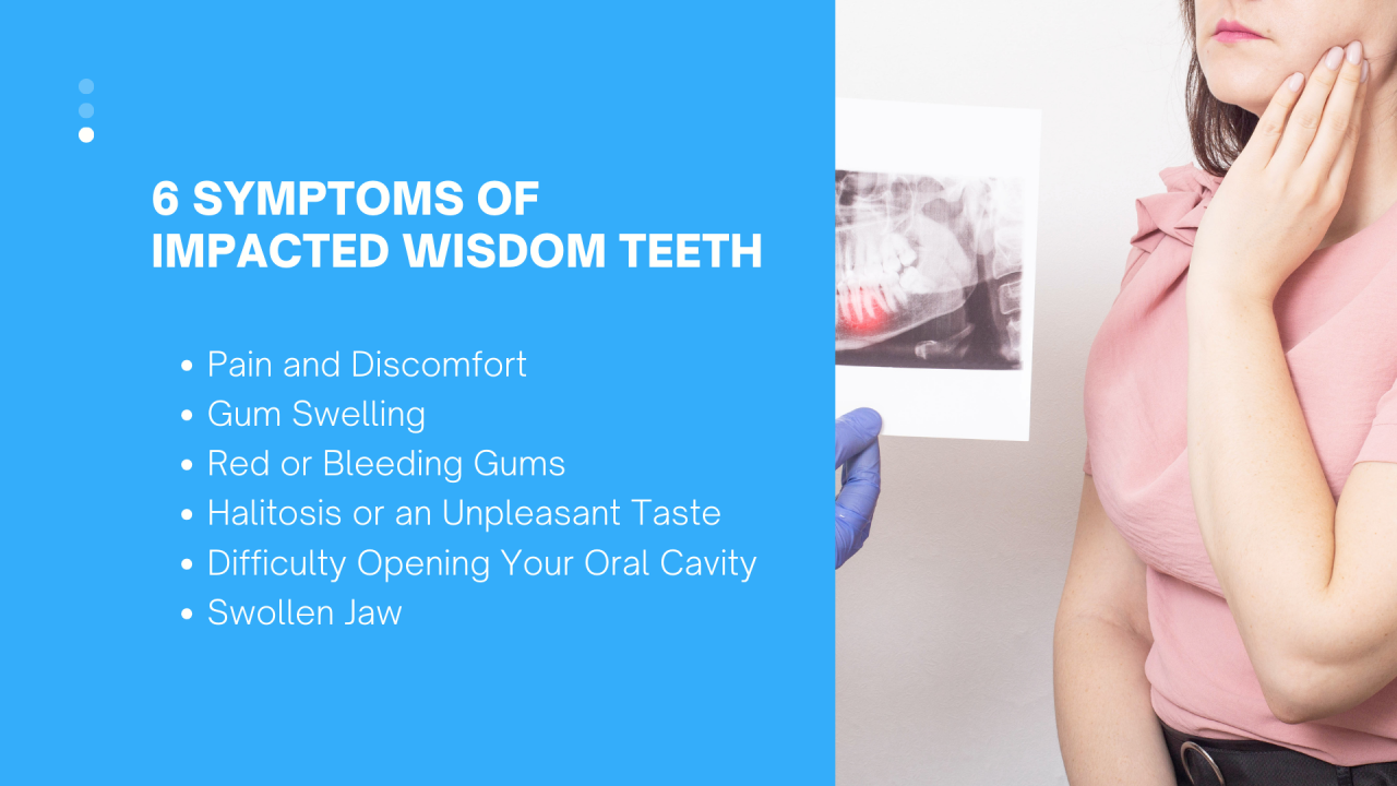 Impacted Wisdom Teeth: Symptoms and Treatment Options