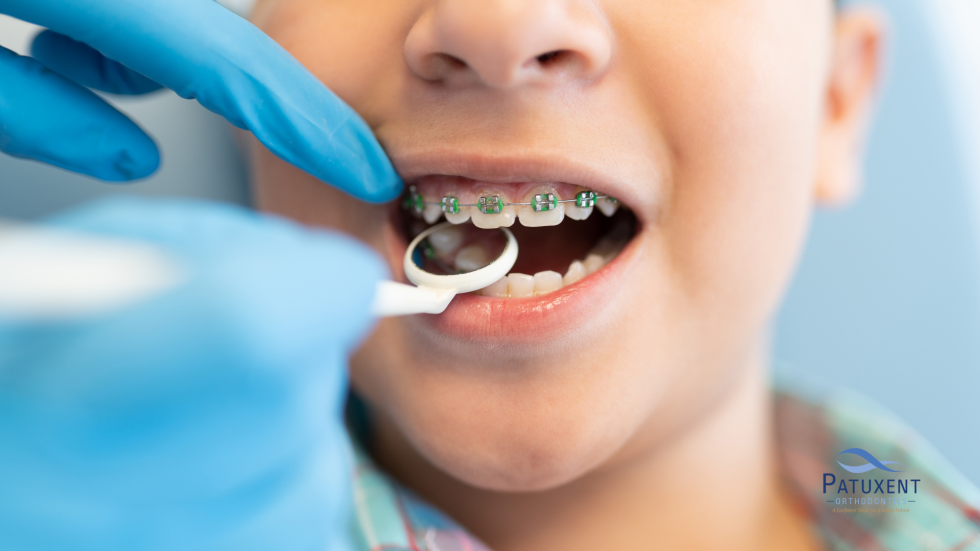 I've Noticed Heavy Plaque on My Braces: What to Do?