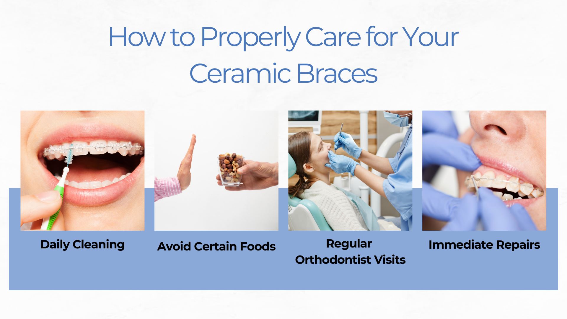 Ceramic Braces in Hollywood, MD