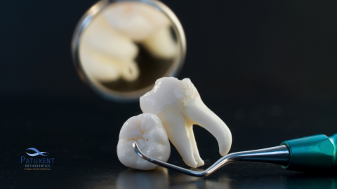 Can Wisdom Teeth Fall Out on Their Own?
