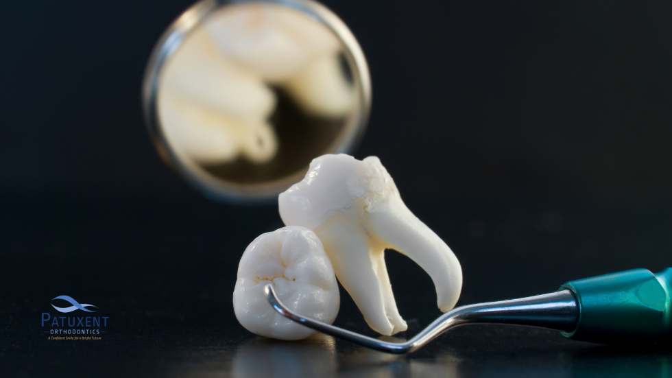 Can Wisdom Teeth Fall Out on Their Own?