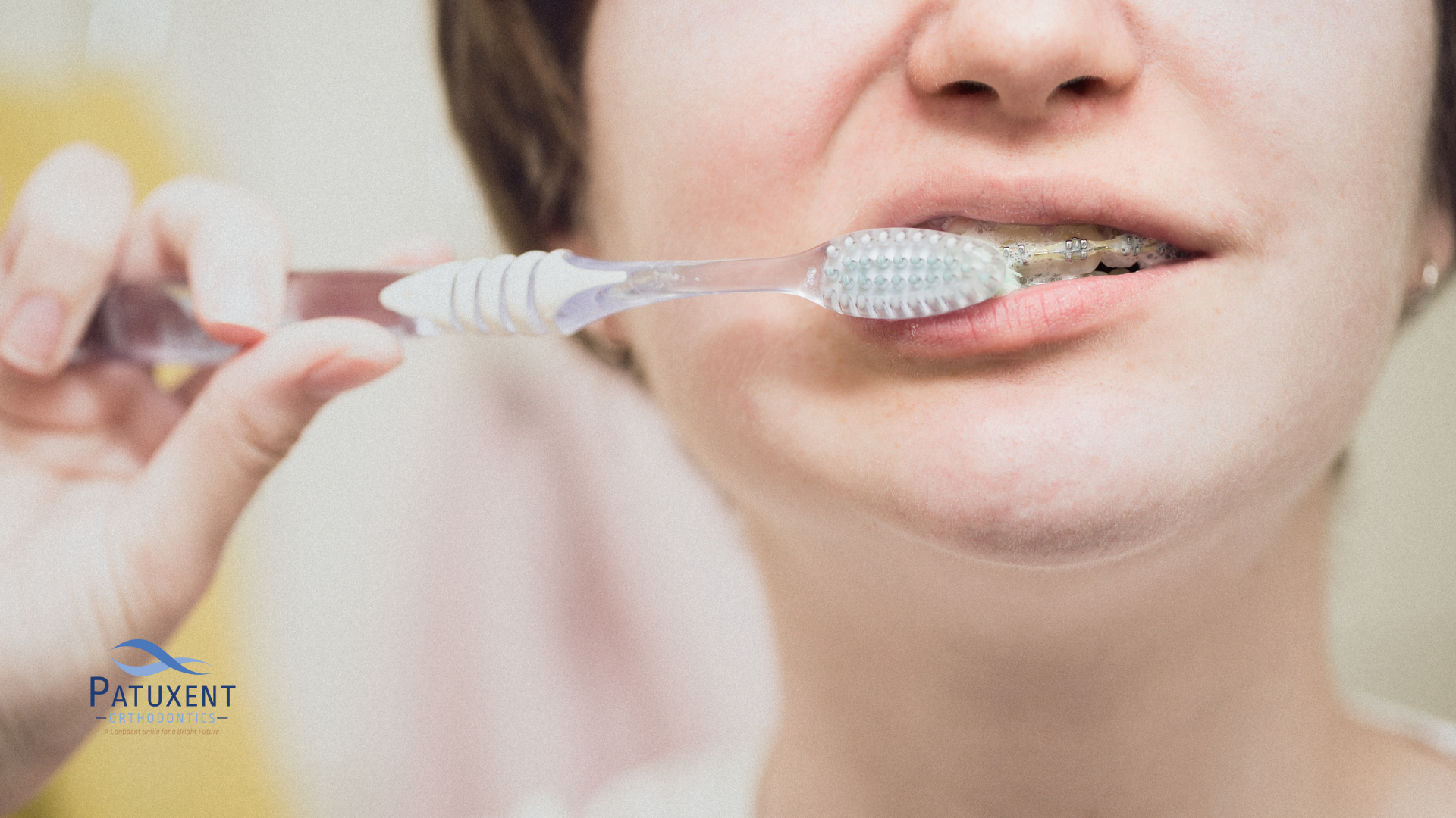7 Essential Tips for Brushing with Braces
