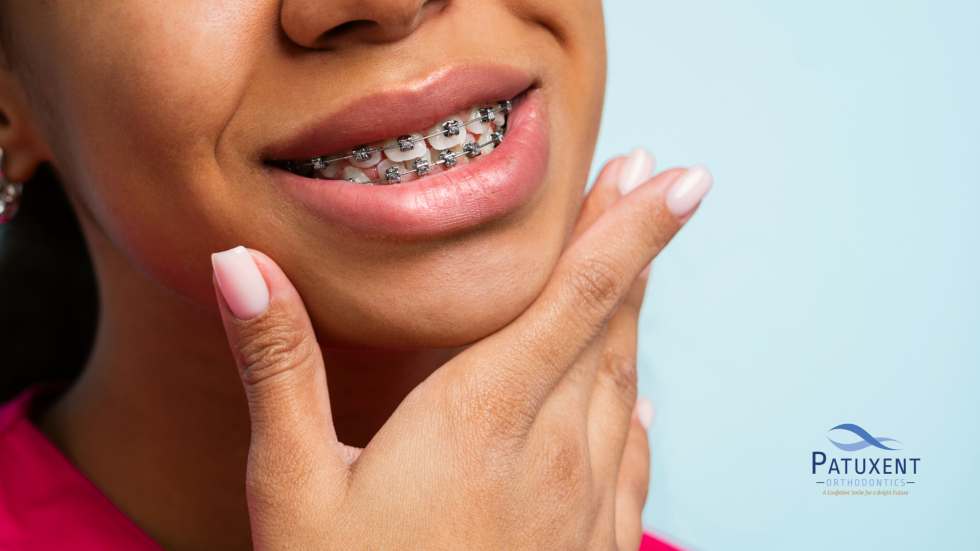 The Role of Braces in Treating Underbites