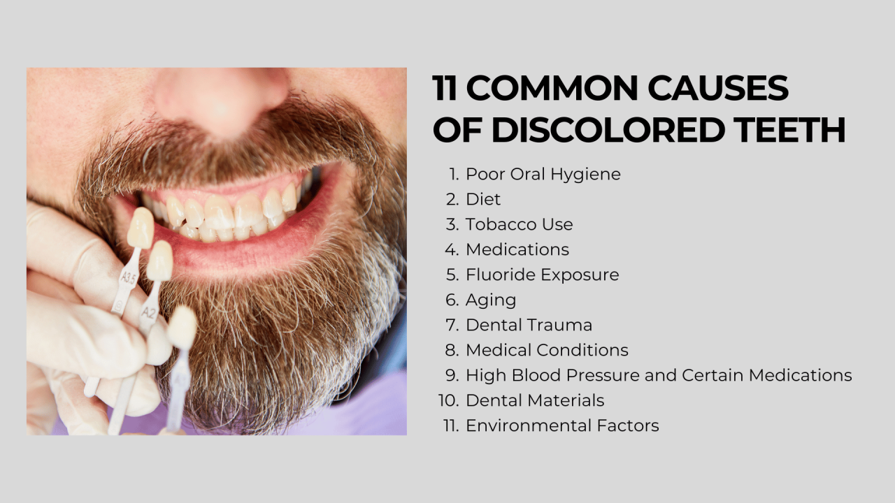 11 Causes of Tooth Discoloration