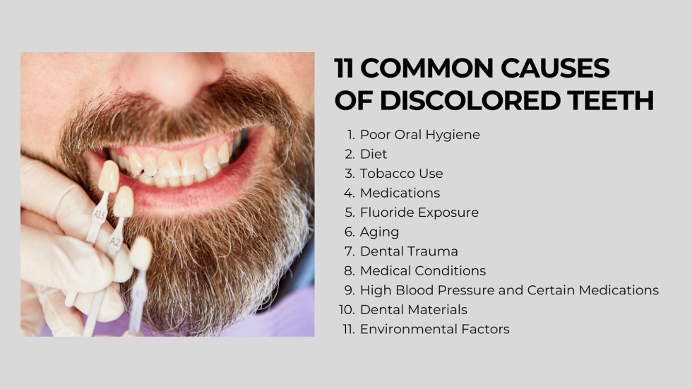 11 Causes of Tooth Discoloration