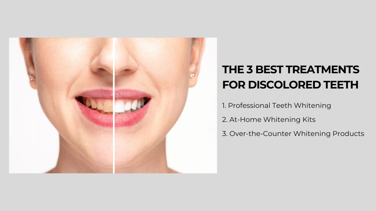 11 Causes of Tooth Discoloration
